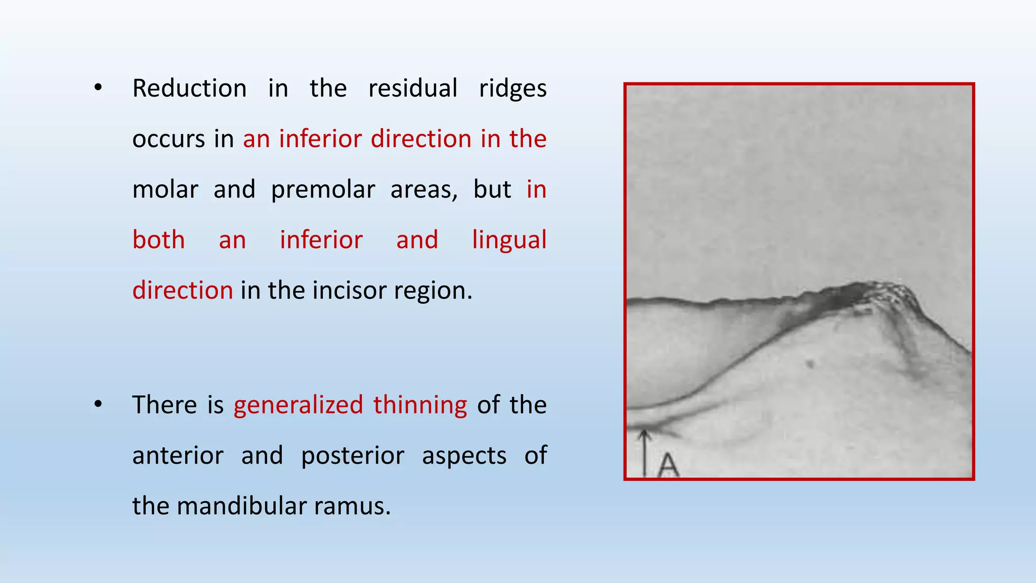 Alveolar bone in prosthodontics | PPTX