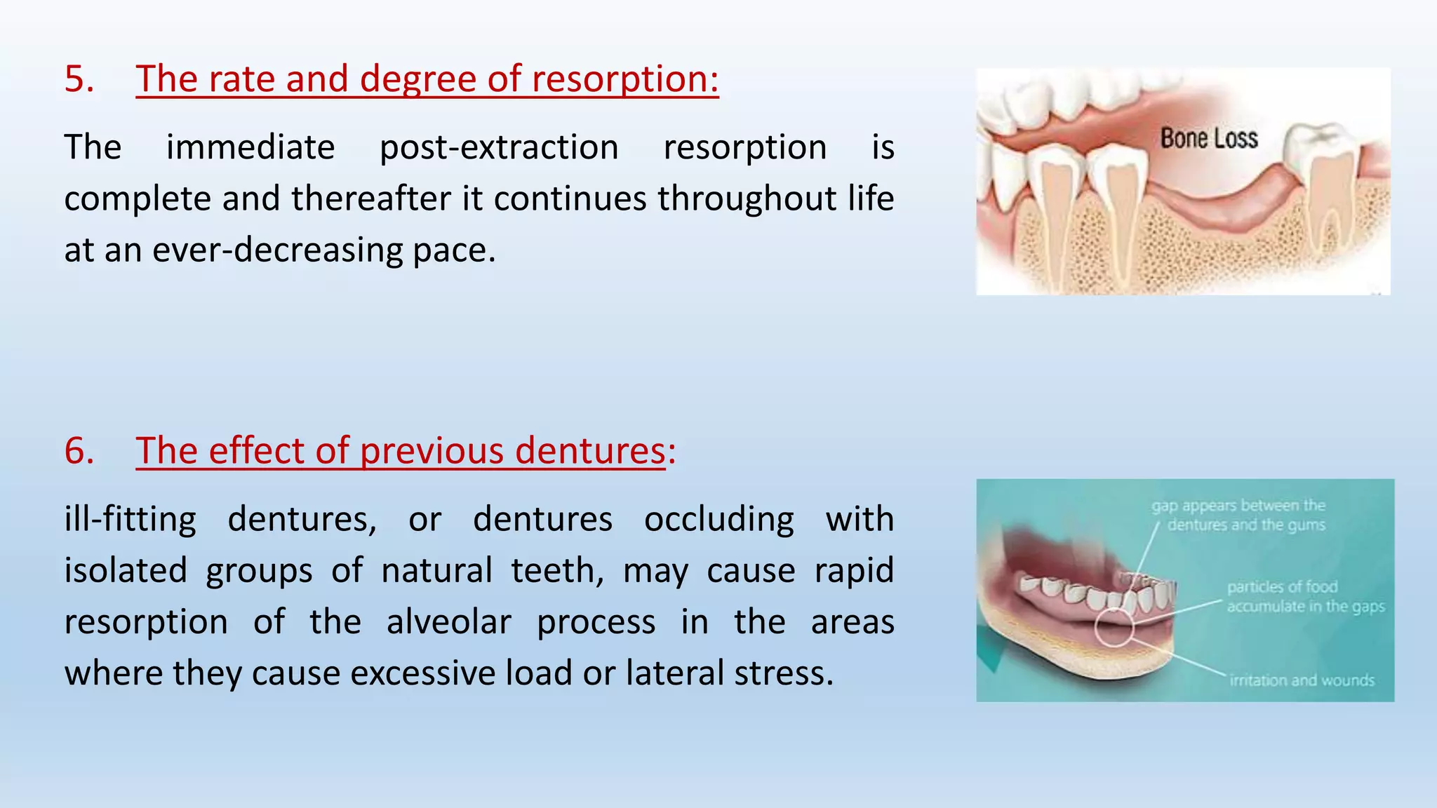 Alveolar bone in prosthodontics | PPTX