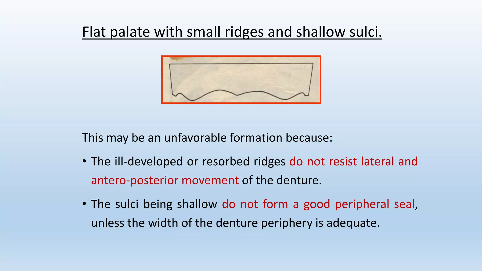 Alveolar bone in prosthodontics | PPTX