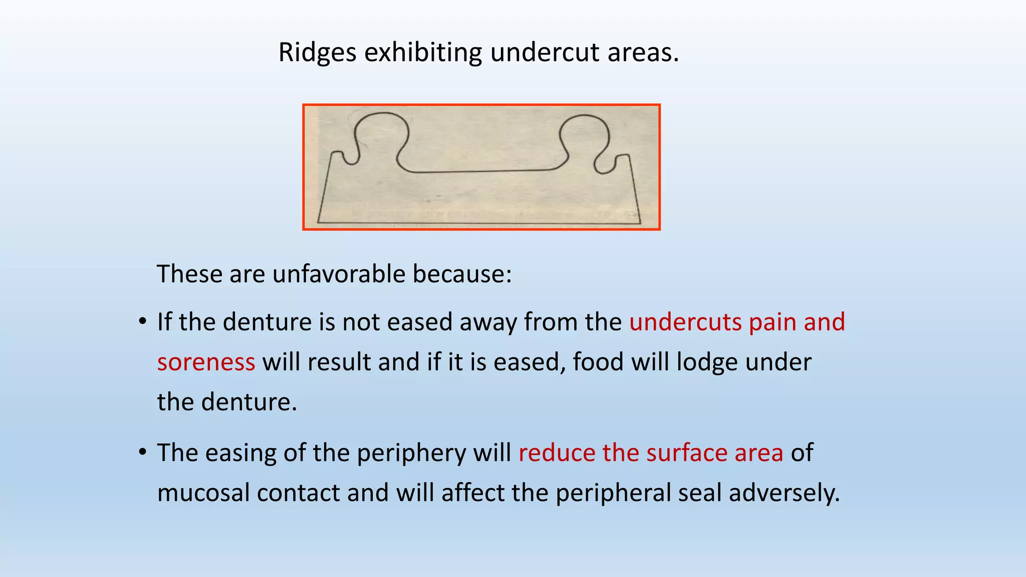 Alveolar bone in prosthodontics | PPTX