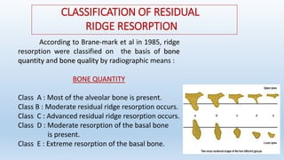Alveolar bone in prosthodontics | PPTX