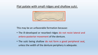 Alveolar bone in prosthodontics | PPTX