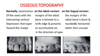 Alveolarbone | PDF