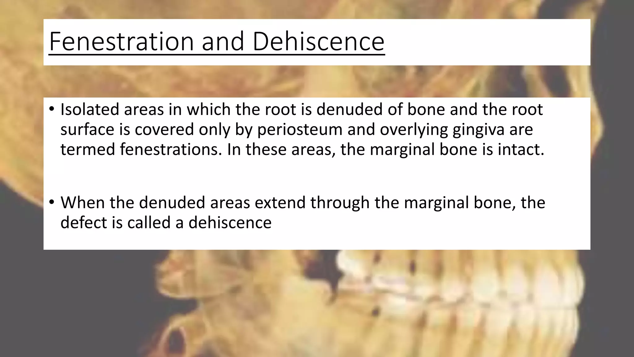 alveolar bone new.pptx