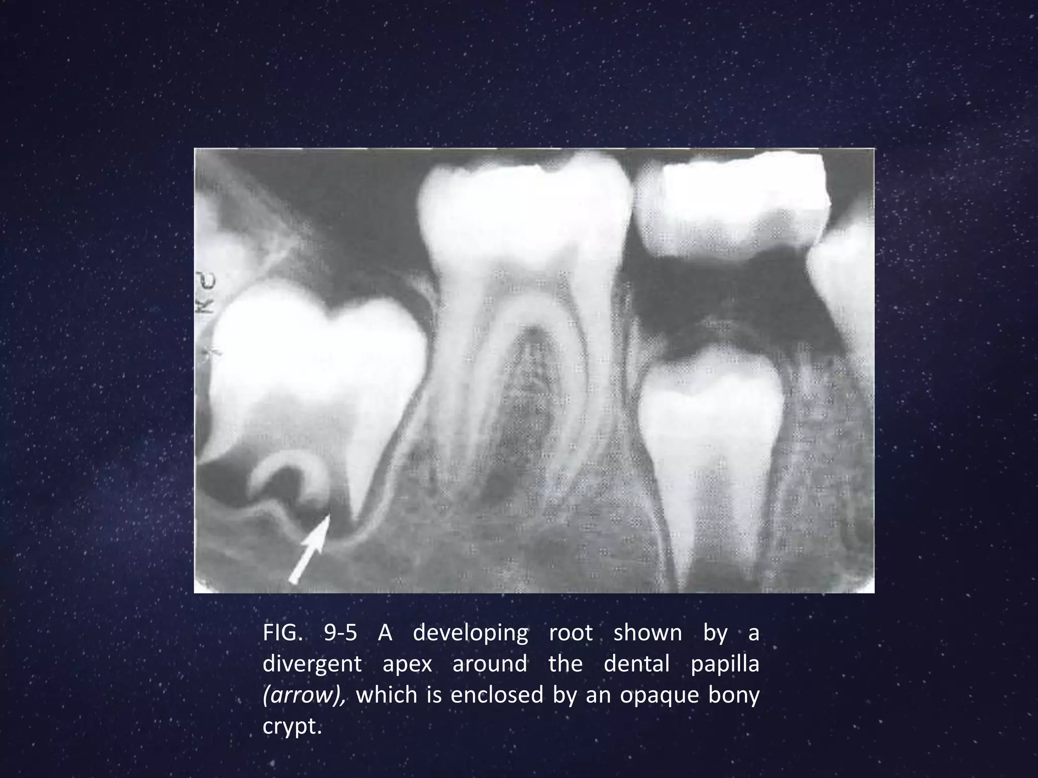 Alveolar process bds class | PPTX