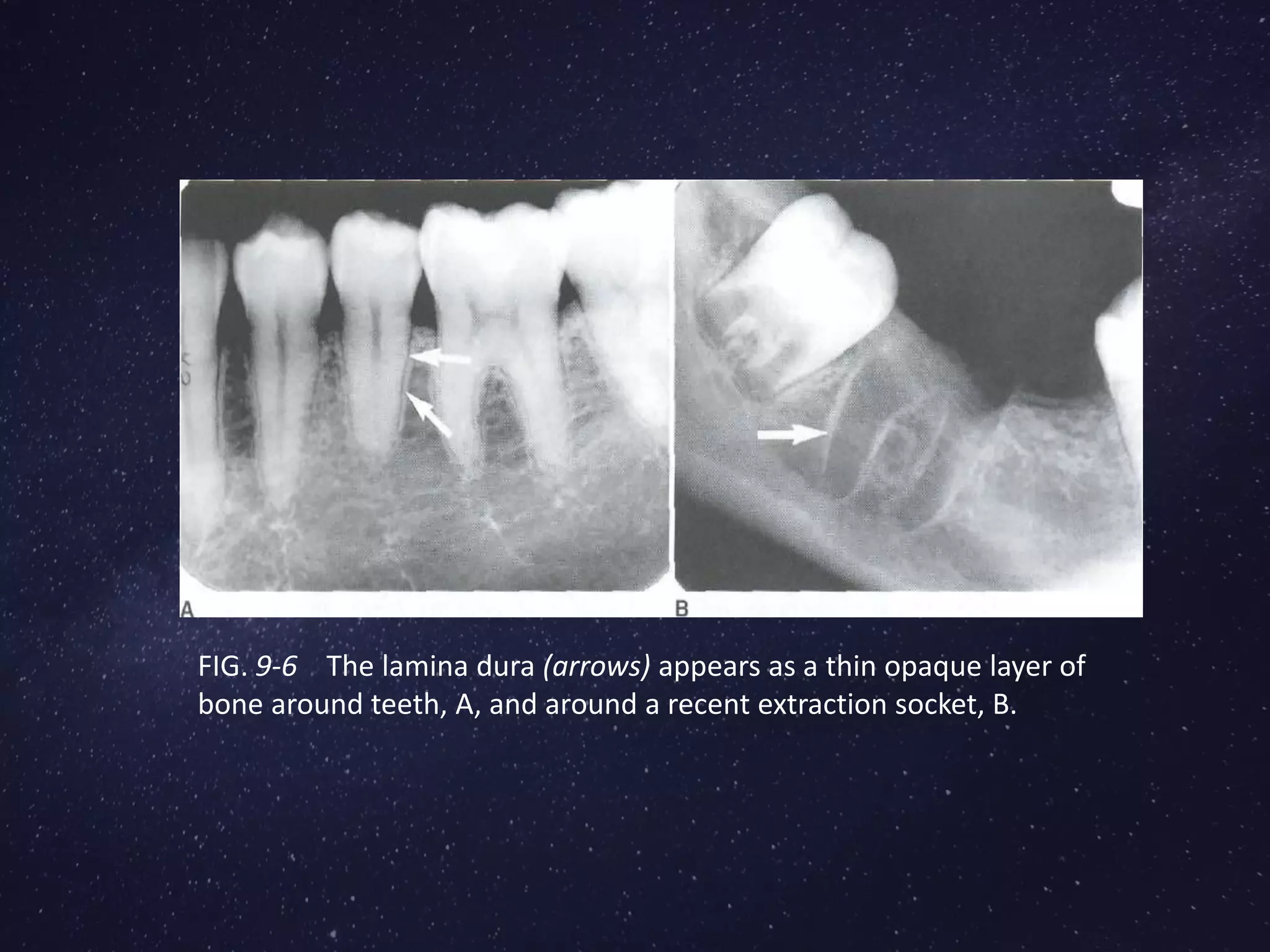 Alveolar process bds class | PPTX
