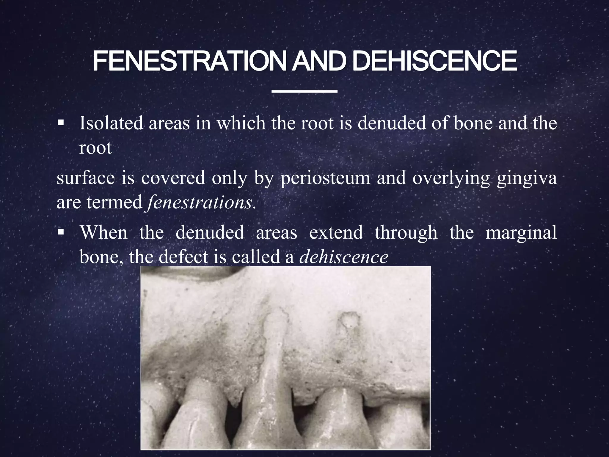 Alveolar process bds class | PPTX