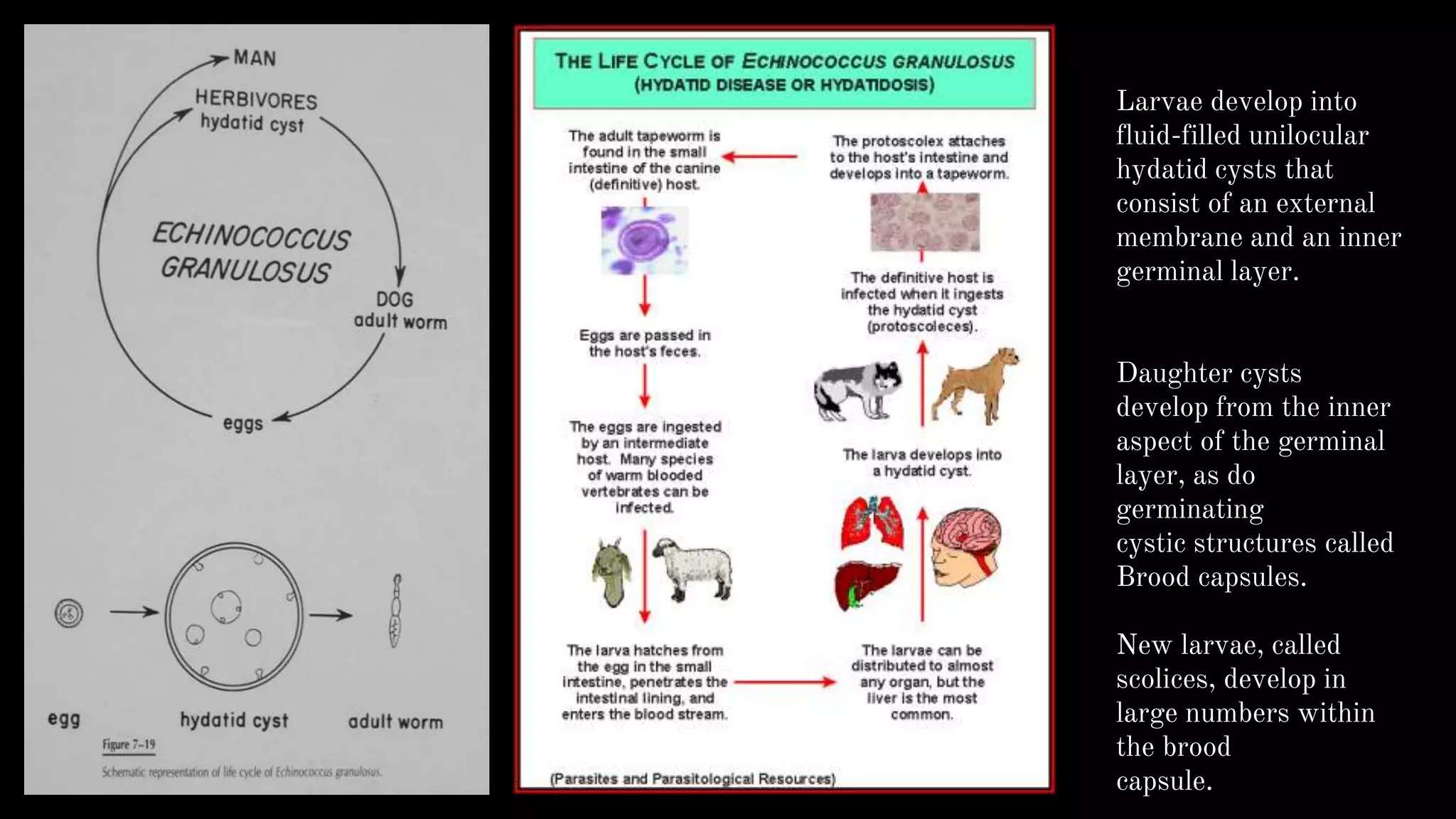 Echinococcosis | PPTX