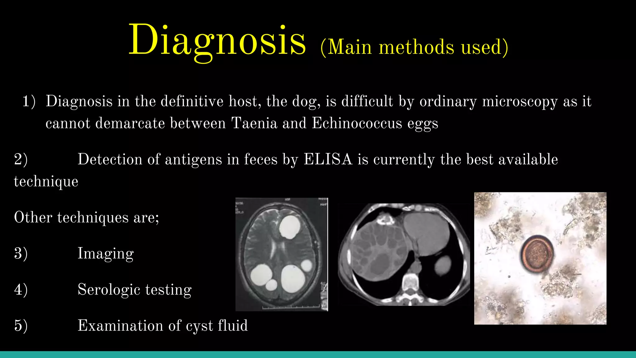 Echinococcosis | PPTX