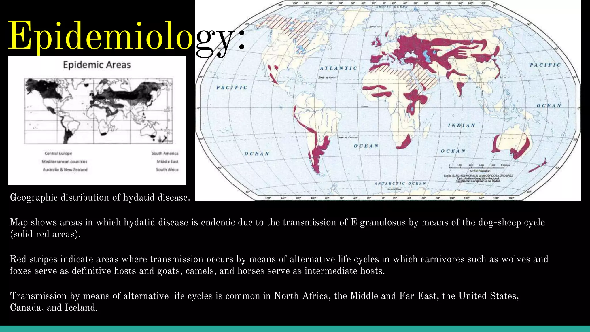 Echinococcosis | PPTX