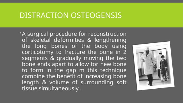 Alveolar distraction - oral & maxillofacial surgery .pptx