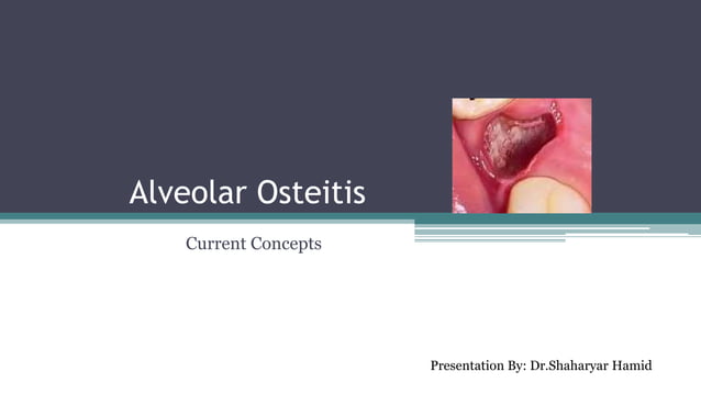Alveolar osteitis - DIKIOHS DUHS | PPTX | Dental Health | Diseases and Conditions