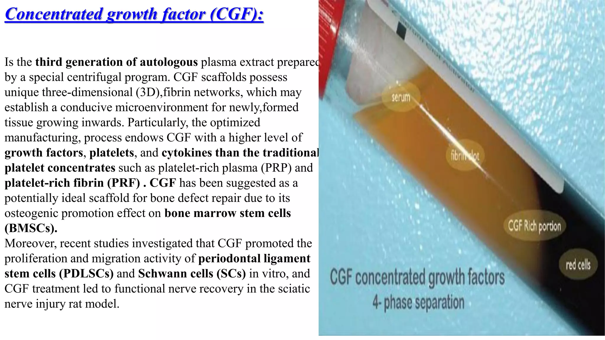 Alveolar Osteitis-DRY SOCKET .pdf