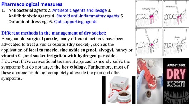 Alveolar Osteitis-DRY SOCKET .pdf