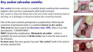Alveolar Osteitis-DRY SOCKET .pdf