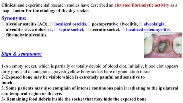 Alveolar Osteitis-DRY SOCKET .pdf