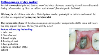 Alveolar Osteitis-DRY SOCKET .pdf
