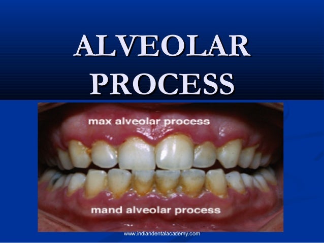 Alveolar process/dental courses