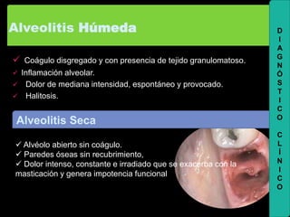 Alveolitis | PPTX
