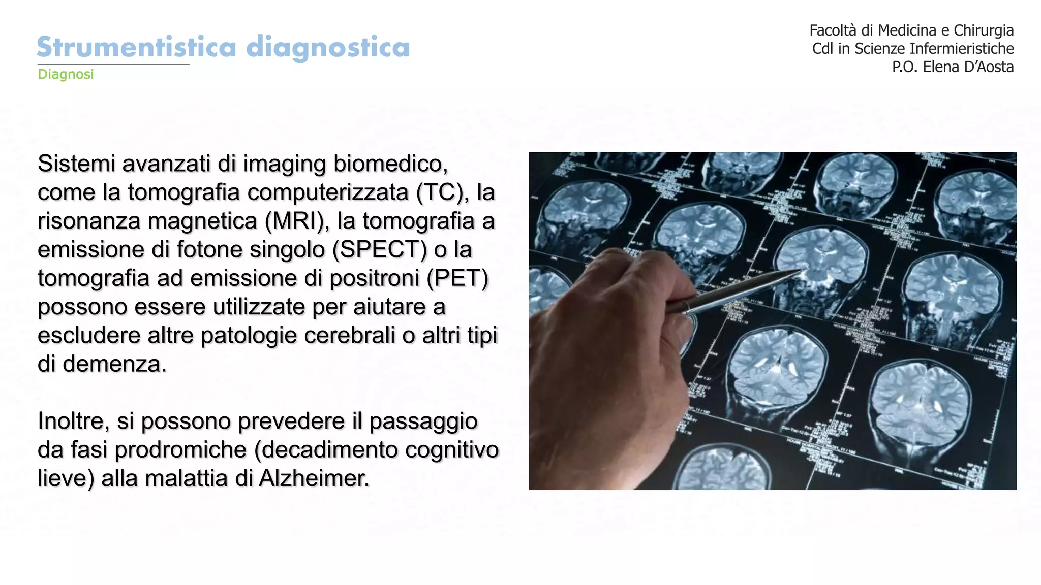 Malattia di Alzheimer | PPTX