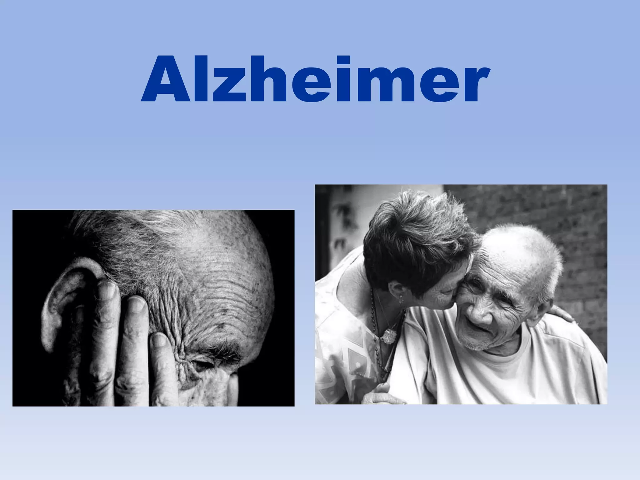 Alzheimer | PPT