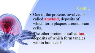 Alzheimer'S Diseases | PPTX