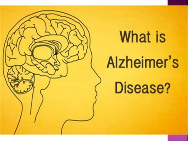 Alzheimer basics | PPTX | Brain and Nervous System Disorders | Diseases ...
