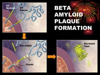 Alzheimer disease | PPT