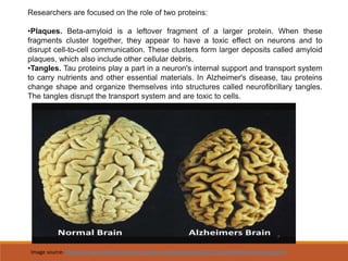 Alzheimer's Disease and its pathophysiology | PPTX