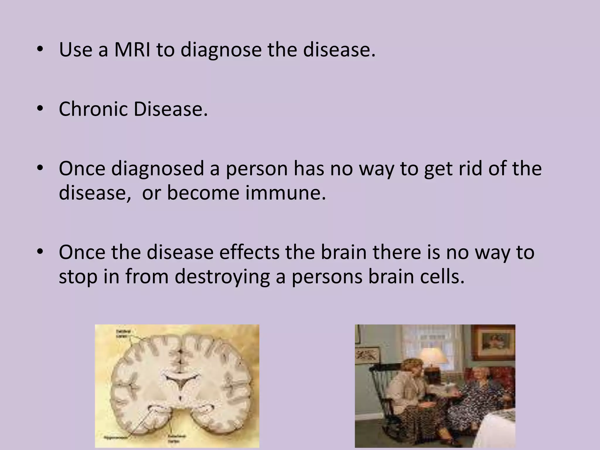 Alzheimers | PPTX