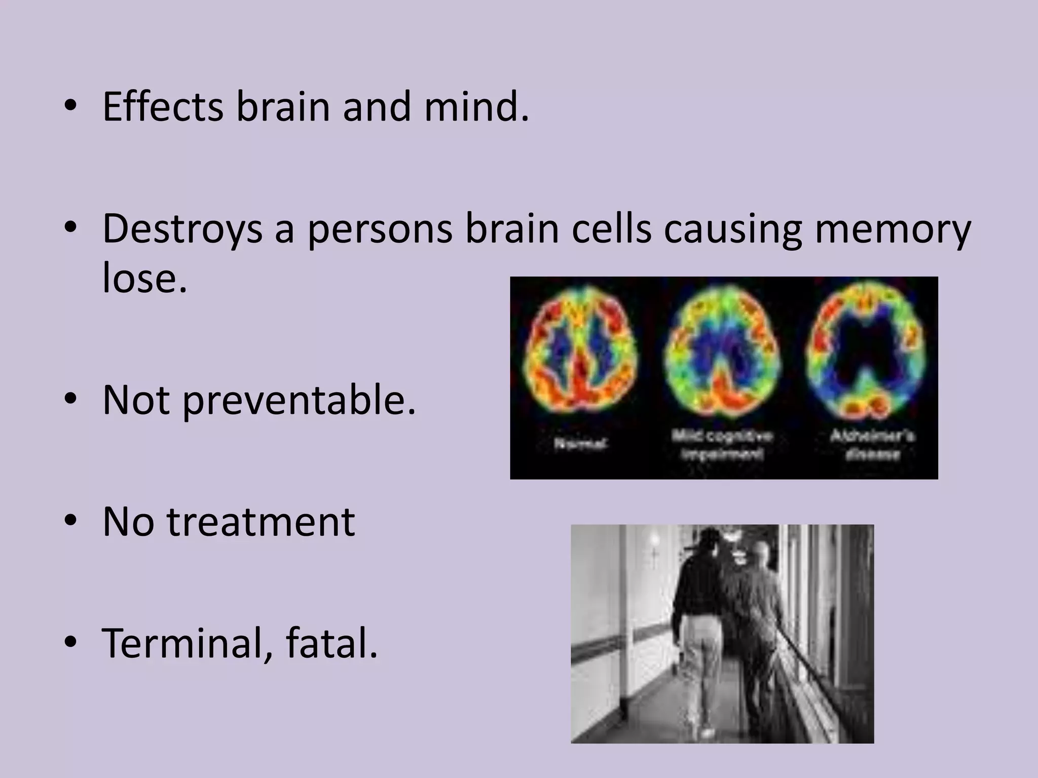 Alzheimers | PPTX