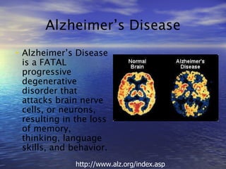 Alzheimers Presentation Lindsay Logan | PPT | Brain and Nervous System ...