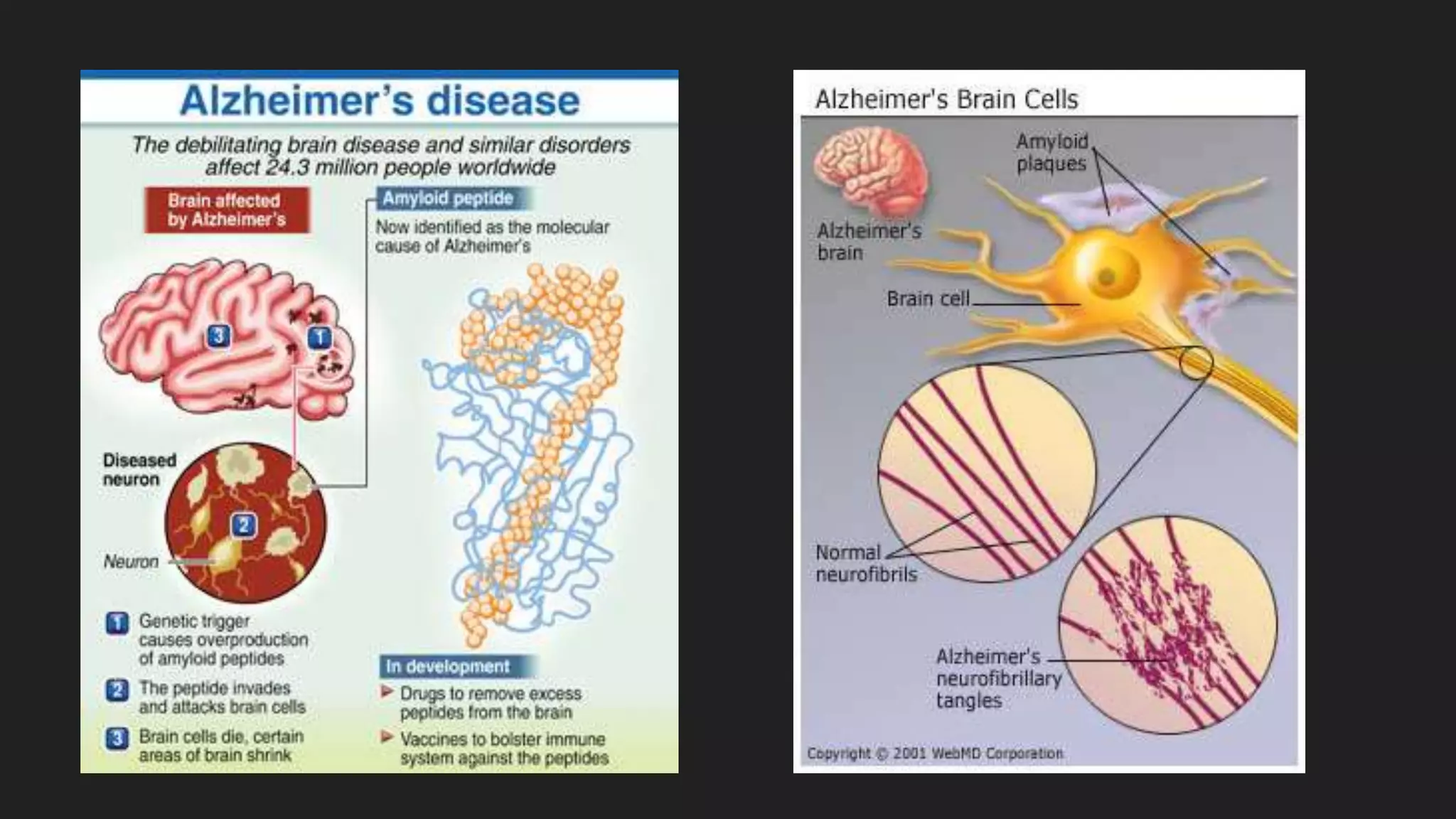 Alzheimers case study ec biochem | PPT