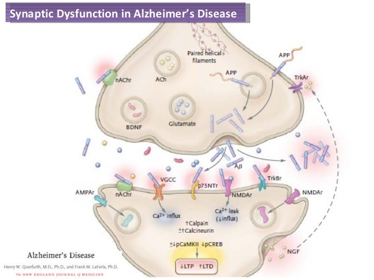 Alzheimer's disease