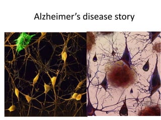 Alzheimer’s disease | PPTX