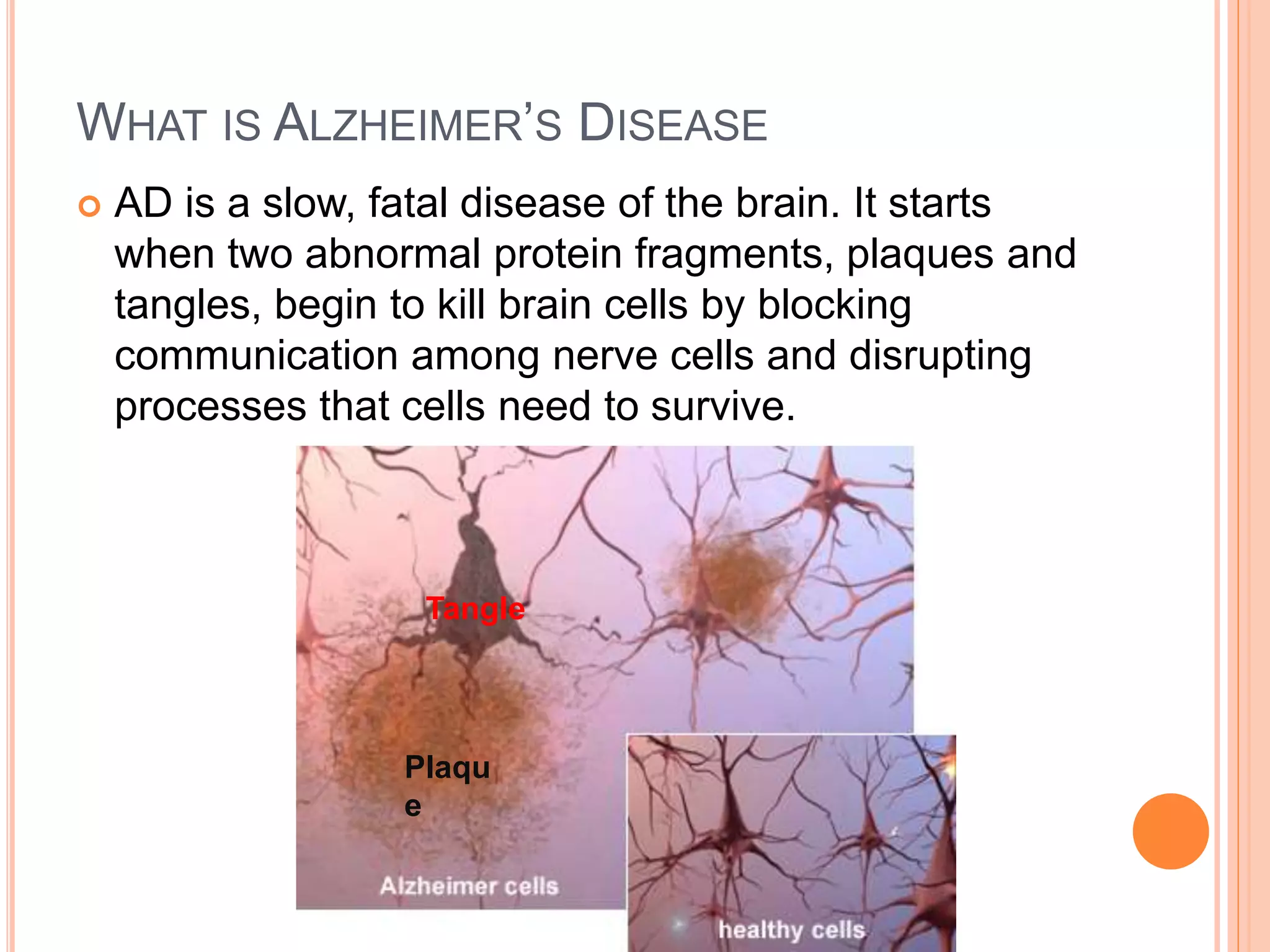 Alzheimer’s disease | PPTX