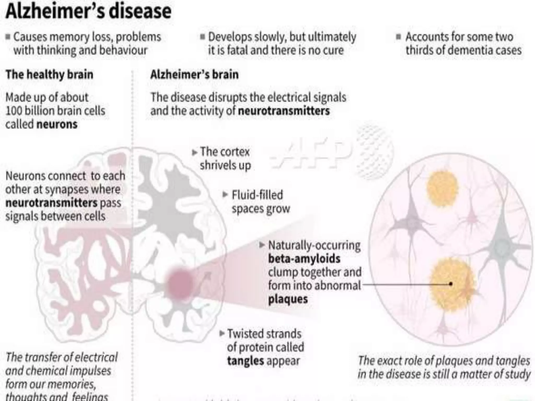 Alzheimer's disease | PPT