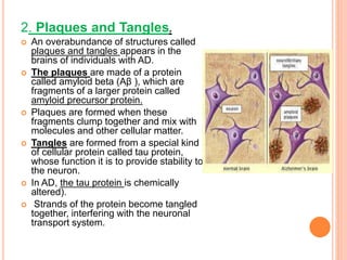 Alzheimers disease by Ritika soni | PPTX