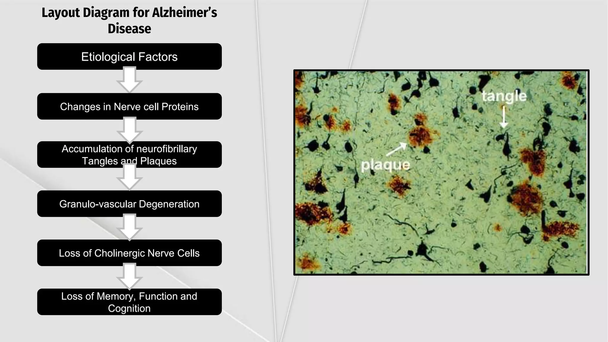 Pathophysiology of Alzheimer's disease | PPTX