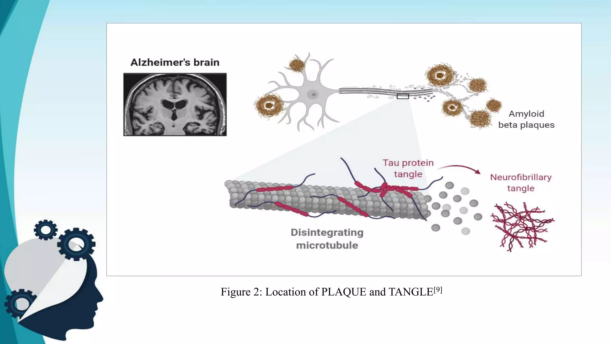 Etiology of TAU & PLAQUE protein in Alzheimer's Disease | PPT