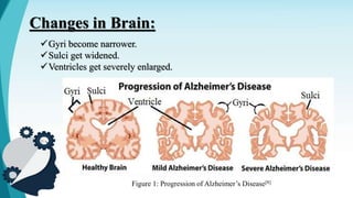 Etiology of TAU & PLAQUE protein in Alzheimer's Disease | PPTX