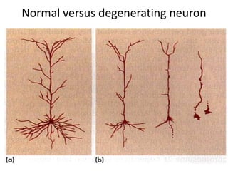 Alzheimer_s Disease.ppt