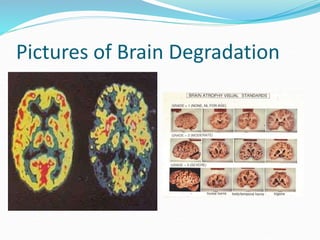 AlzheimersDisease-deepansha ppt.ppt