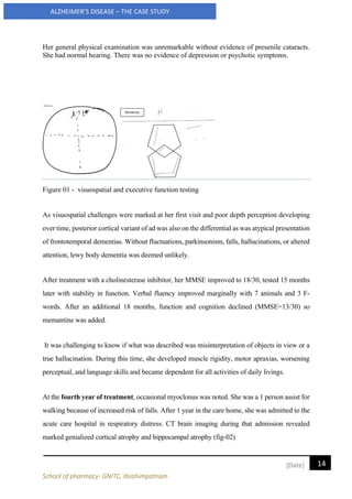 Alzheimer's disease - A detailed case study | PDF