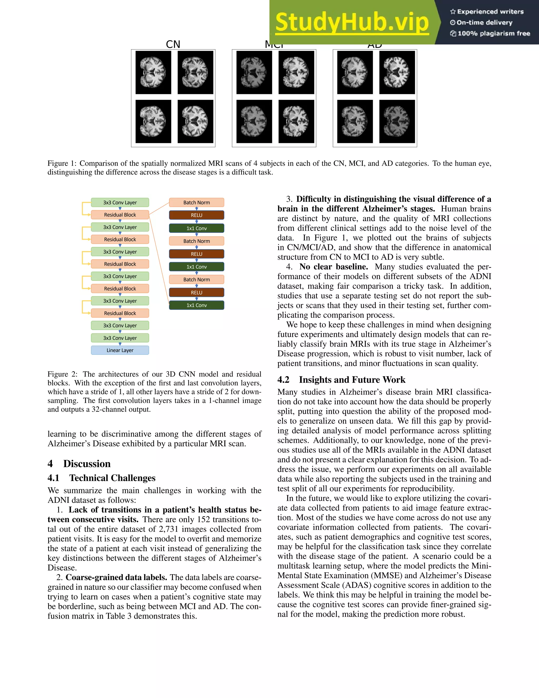 Alzheimer S Disease Brain MRI Classification Challenges And Insights | PDF