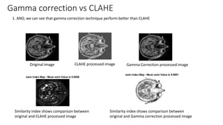 Alzheimer's disease classification using Deep learning Neural a Network ...