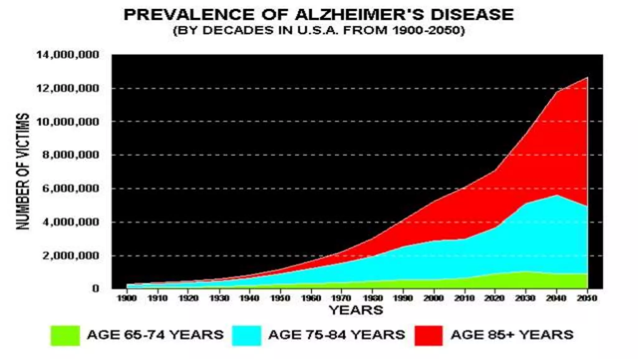 Alzheimer’s disease ppt | PPTX