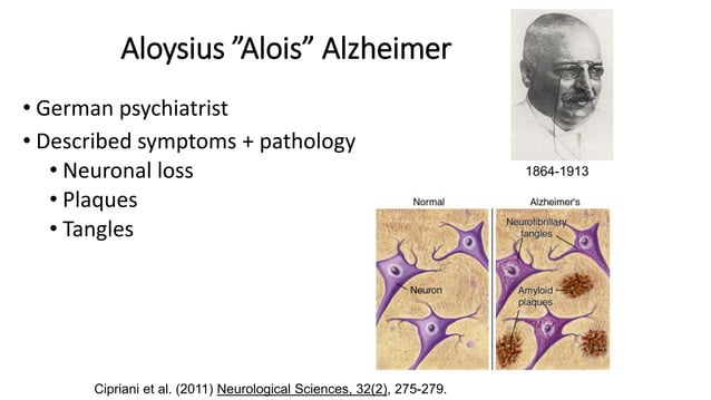 Alzheimer’s disease ppt | PPTX