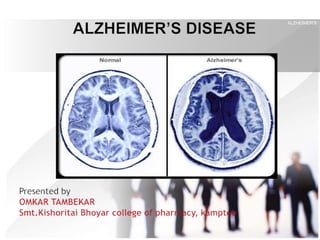 Alzheimers Diseases | PPT