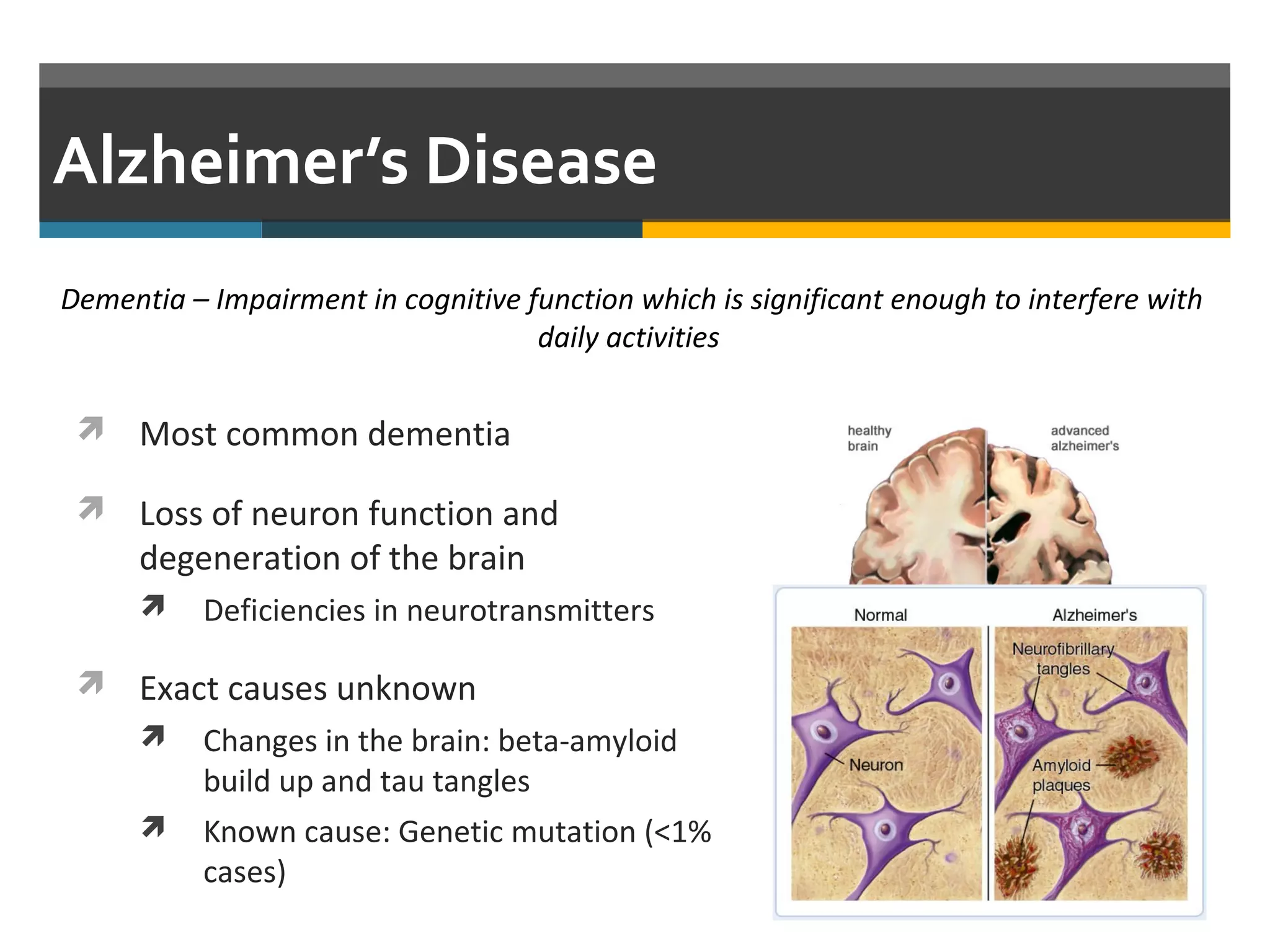 Alzheimer's Presentation | PPT